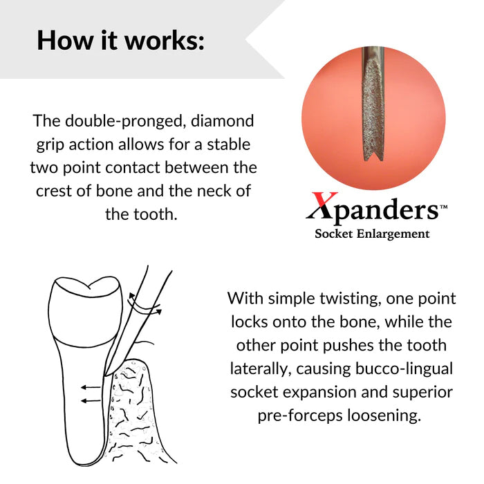 Xpanders Socket Expander 3 Different Set Packs – DENTALREE